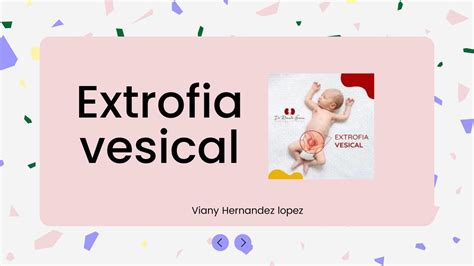 Extrofia Vesical Esmeralda Santiago Udocz