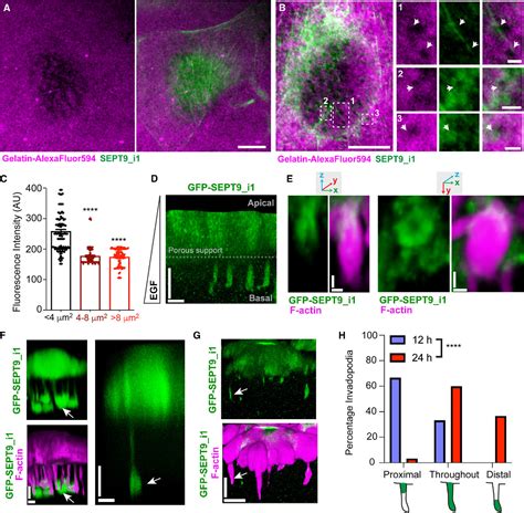 Figure 1 From An Oncogenic Isoform Of Septin 9 Promotes The Formation