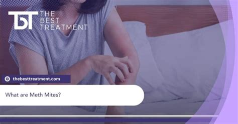 What Are Meth Mites And What Causes Them