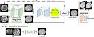 Qacl：通过同时配准进行腹部 Mr To Ct 合成的四重注意感知闭环学习medical Image Analysis X Mol