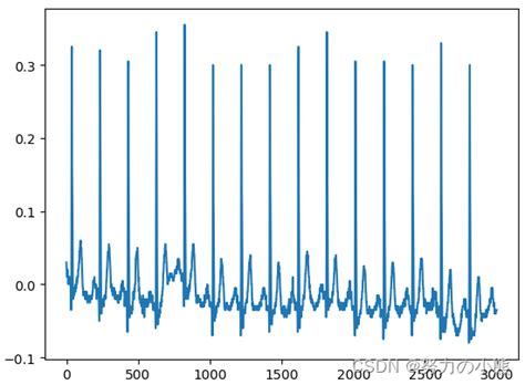 Mimic Iv波形数据库之心电信号如何从mimic4数据中找到心电数据 Csdn博客