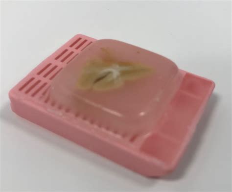 Post Mortem Brain Tissues Advanced Tissue Services