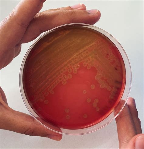 I Would Like To Share My Enthusiasm For Starting My Internship At The Institute Of Molecular