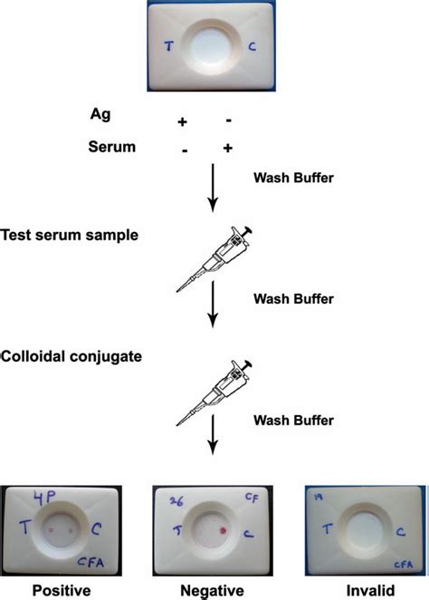 Gold Flow Through Assay For Antibody Detection Using Protein A