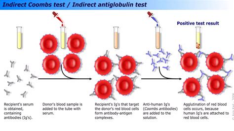 Isoimmunization Pptx