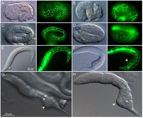 Hypodermal Cell Defects In Ten 1ok641 Embryos All Animals Shown Are