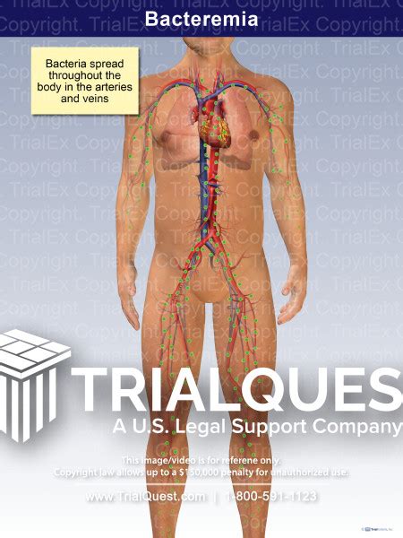 Bacteremia
