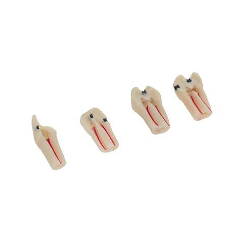 Frasaco X Ray Endo Tooth No 21 With Caries 1127937 Henry Schein Uk