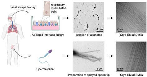Sperm Cell Under Microscope Labeled
