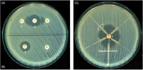 A Double Disc Synergy And B Phenotypic Confirmatory Test For Esbl Download Scientific