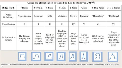 Ridge Split Techniques In Prosthodontics Enhancing Alveolar Ridge For