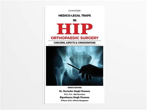 Medico Legal Traps In Hip Orthopaedic Surgery Customed