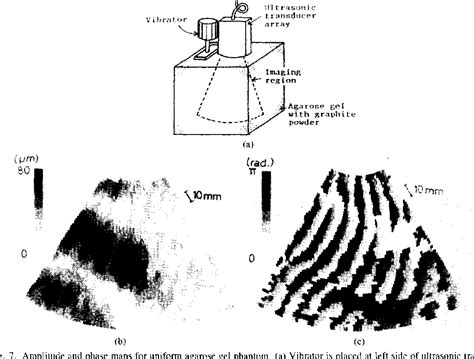 Ultrasonic Imaging Of Internal Vibration Of Soft Tissue Under Forced Vibration Semantic Scholar