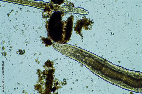 Human Parasite Gut Intestinal Infection Disease Microorganism