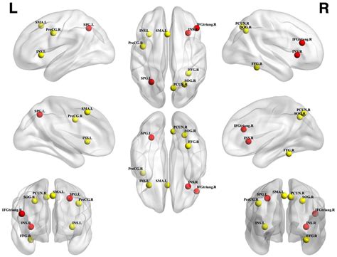 Frontiers The Right Inferior Frontal Gyrus Plays An Important Role In Unconscious Information