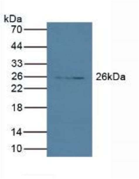 Trypsin 2 Polyclonal Antibody Invitrogen™ 100 μl Unconjugated