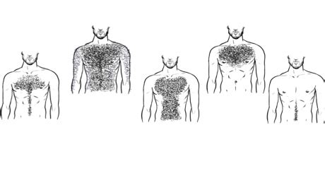 Male Body Hair Stages