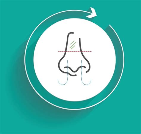 Congested Nasal Passages 20개가 넘는 로열티 프리 라이선스 대상 스톡 벡터 및 벡터 아트 Shutterstock
