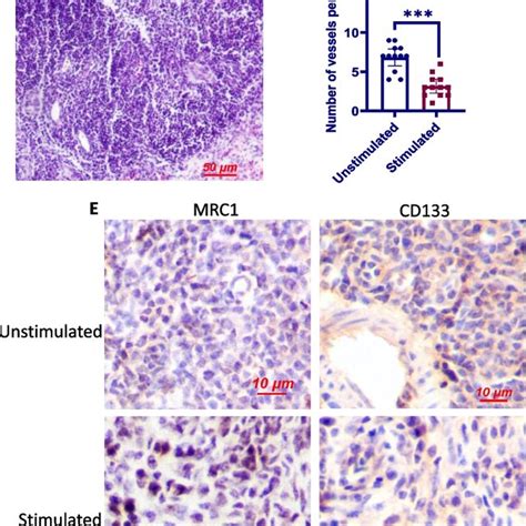 Characterization Of The Phenotypes Of Cells Within Plexiform Lesions Download Scientific