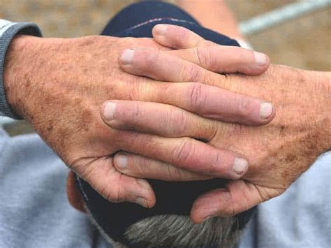 Hyperkeratosis