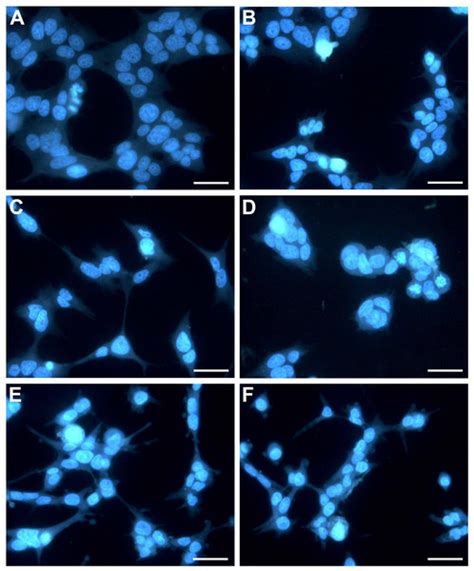 Can Macroalgae Provide Promising Anti Tumoral Compounds A Closer Look At Cystoseira