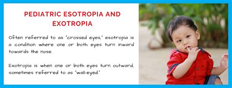 Pediatric Esotropia And Exotropia Conditions And Treatments