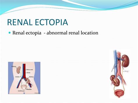 Ppt Anatomy And Physiology Of The Urinary System Powerpoint