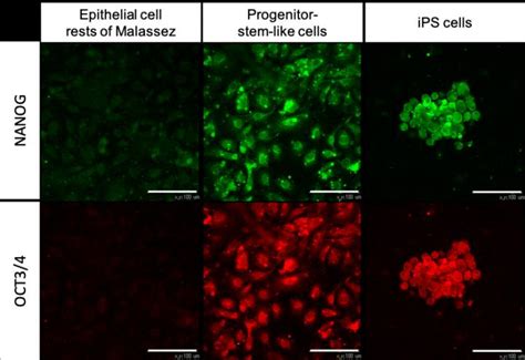 Figure 1 Immunocytochemical E Image Eurekalert Science News Releases