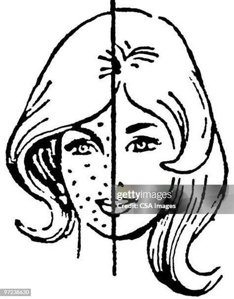 Before And After Acne Photos And Premium High Res Pictures Getty Images