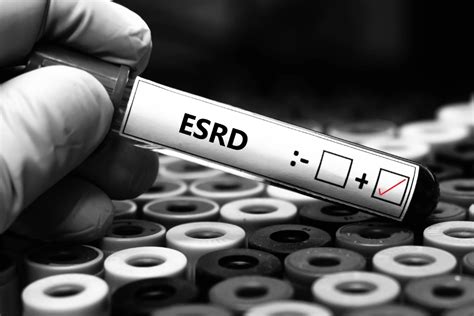 How Medicare Works When You Are Diagnosed With Esrd End Stage Renal Disease The Medicare Site