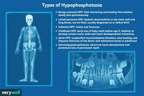 Hypophosphatasia Symptoms And Causes