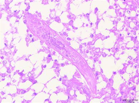 Longitudinal Section Of A Nematode Was Found With Infiltrations Of Download Scientific Diagram
