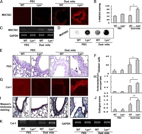 Chronic Allergen Exposure Induced Mucus Hypersecretion And Download Scientific Diagram