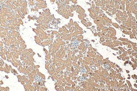 Fpgs Antibody 27616 1 Ap Proteintech