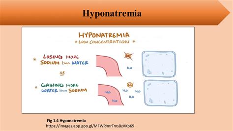Abnormalities Of Aldosterone Hormonepdf