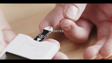 Neuropathy And Diabetes Causes Symptoms And Treatment Options Diabetes