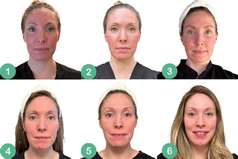 7 Eye Opening Differences Between Ablative Vs Non Ablative Lasers That