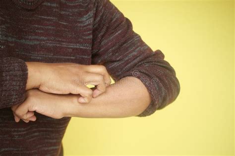 Man Suffering From Itching Skin Close Up Stock Image Image Of