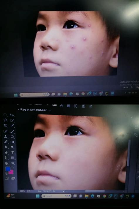 How Photoshop Can Remove Acne And Enhance Beauty Naila Awan Posted On