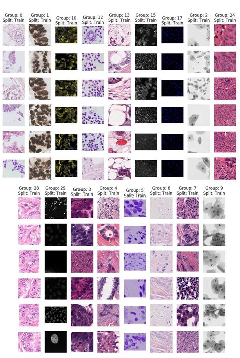 Nuclei Segmentation In Microscope Cell Images Kaggle