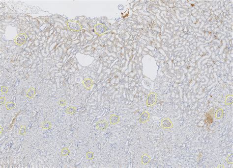 Deep Learning Object Segmentation Orbit