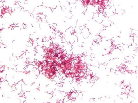 Actinomyces Current Research Review