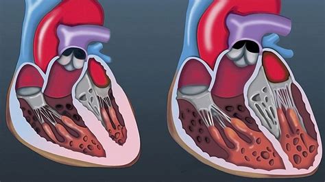 Cardiovascular Services Innovations In Review 2020 Newyork