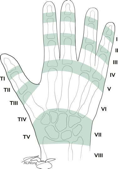 Extensor Tendon Zones Diagram Quizlet