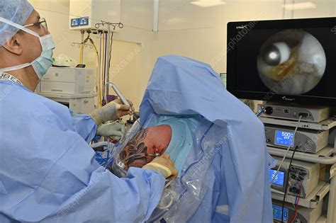 Shoulder Arthroscopy Stock Image C0495131 Science Photo Library