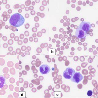 Promonocyte Vs Monoblast