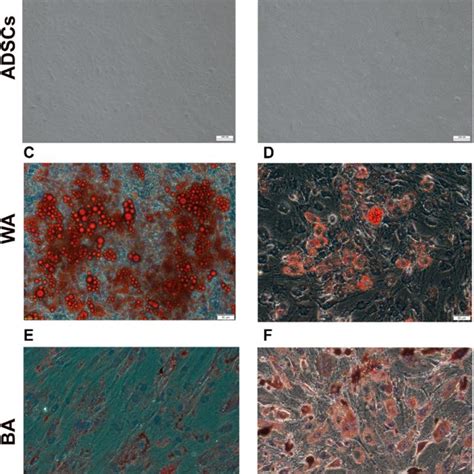 Human Adipose Derived Stem Cells Adscs Were Induced To Differentiate