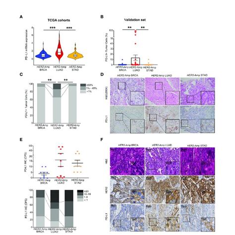 Correlation Between Her2 Amplification And Pd L1 Andor Other Immune