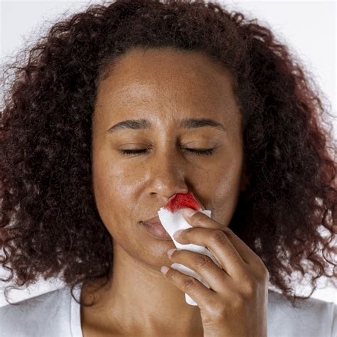How To Stop Nose Bleeds Mistery Fit