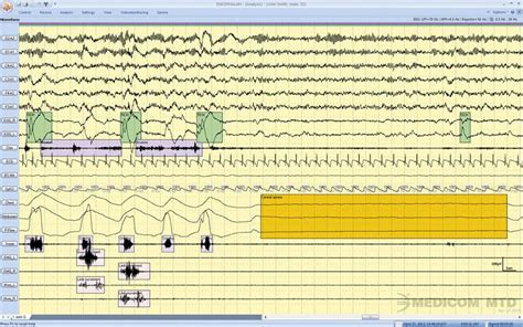 Health Management And Leadership Portal Polysomnography Software